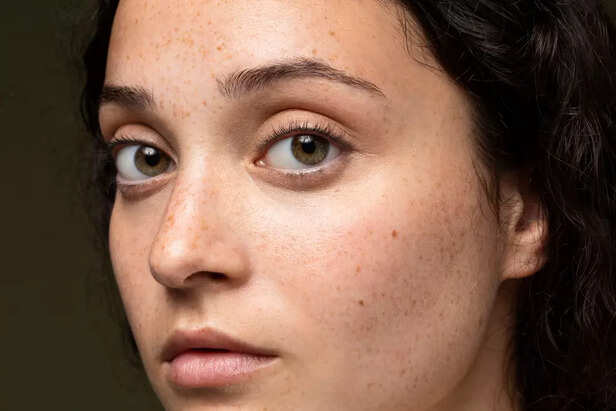 Dull Face? Reasons why skin lost its natural glow